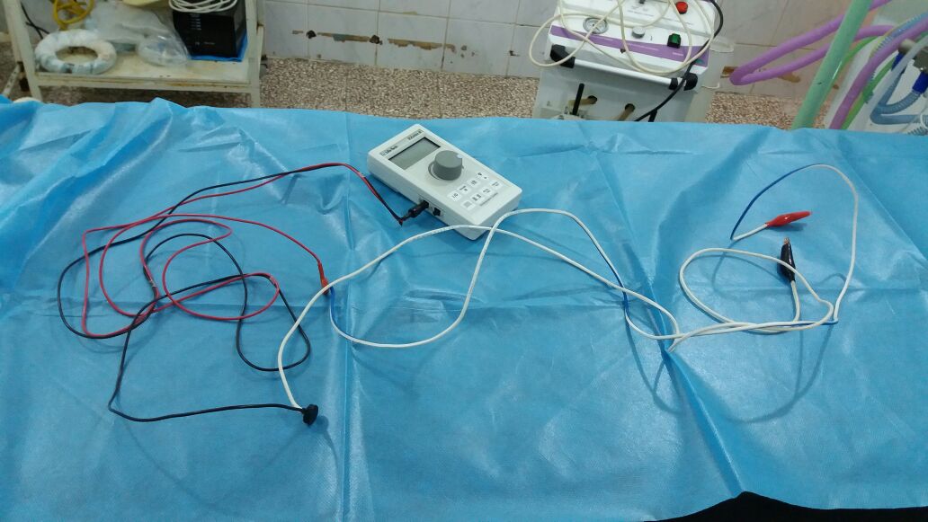 The Cheap Pena Stimulator | British Association of Paediatric Surgeons