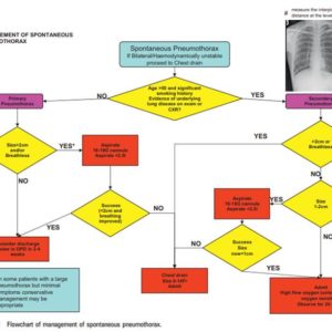 BTS Guidelines | British Association of Paediatric Surgeons
