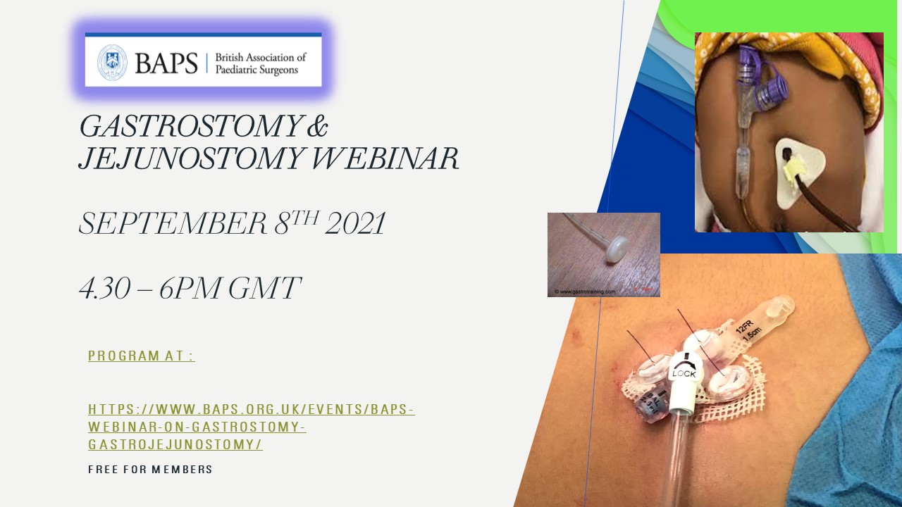 Percutaneous Gastrojejunostomy