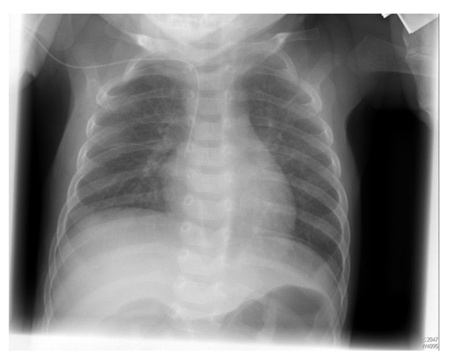 National Lines Survey | British Association of Paediatric Surgeons